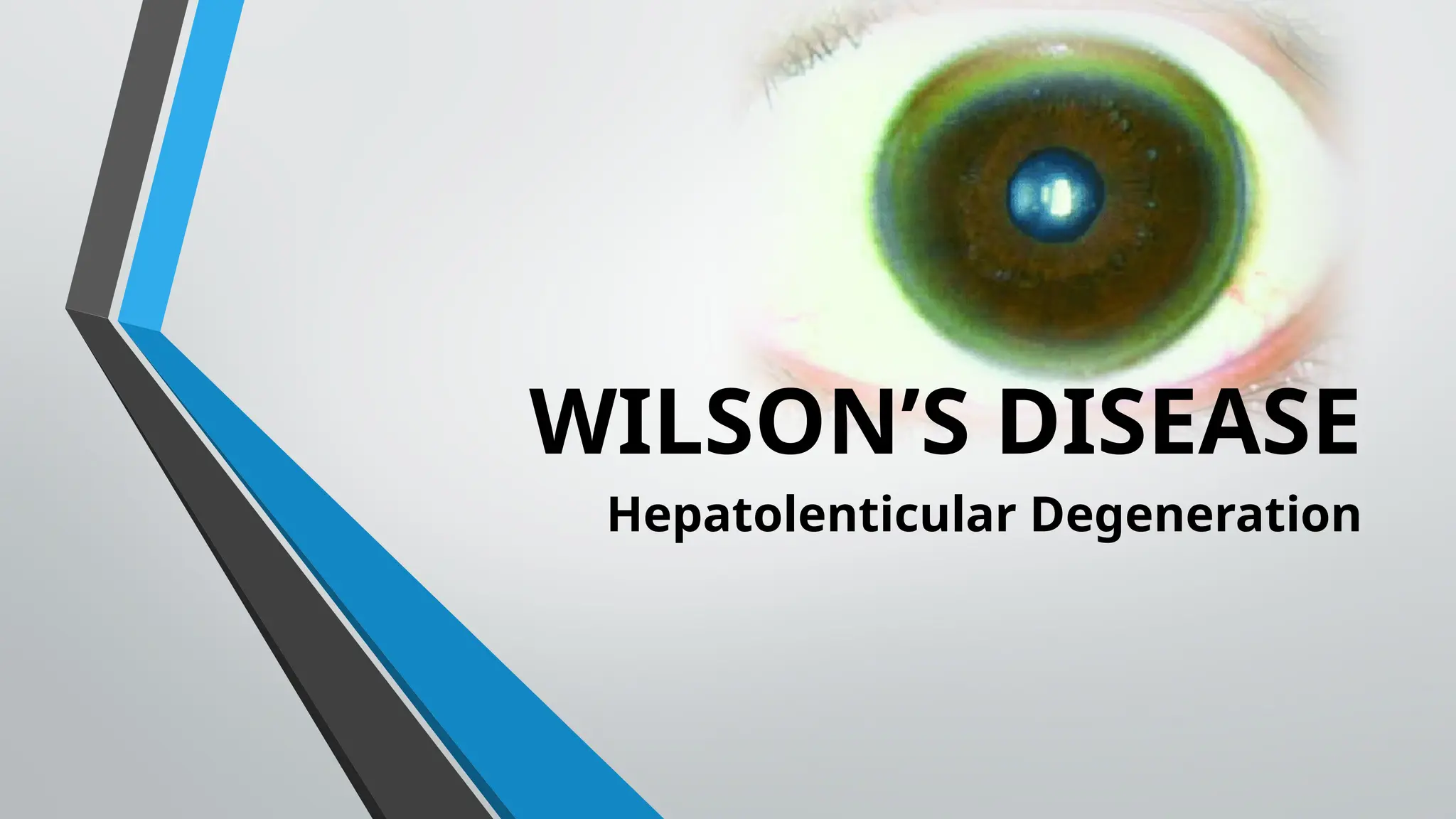 Wilson’s Disease Case Study and Treatment - CPC.pptx