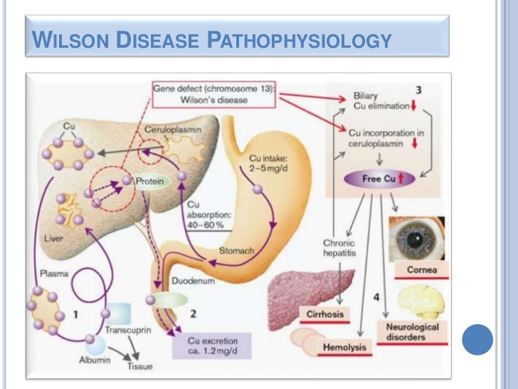 Wilson Disease