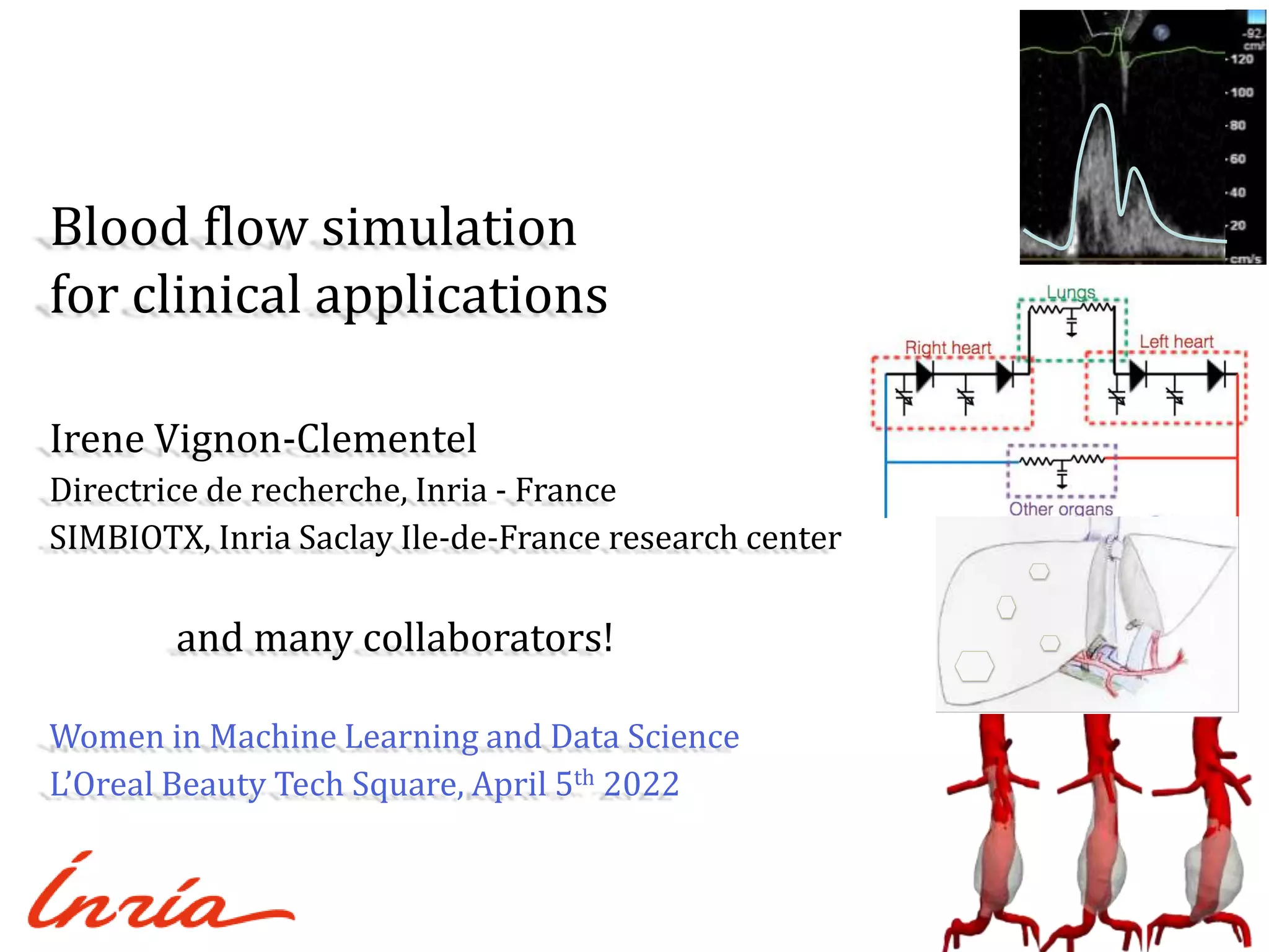 "Blood flow simulation for clinical applications" by Dr Irene Vignon ...