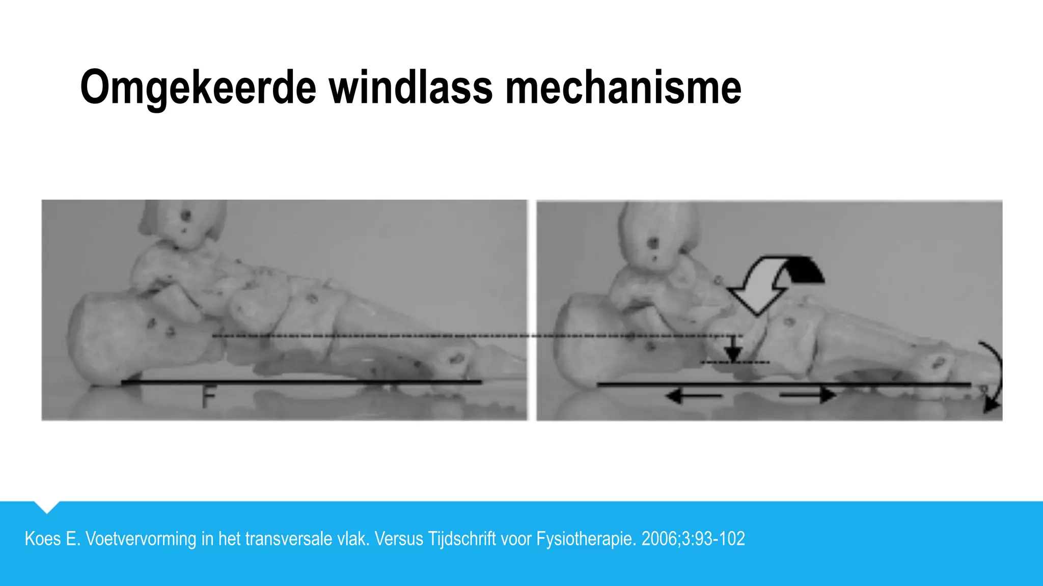 Windlass mechanisme voor SMTU 13-04-2018 | PPT