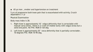 windswept deformity in total knee replacement .pptx