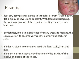 Winter and skin diseases | PPTX