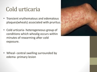 Winter and skin diseases | PPTX