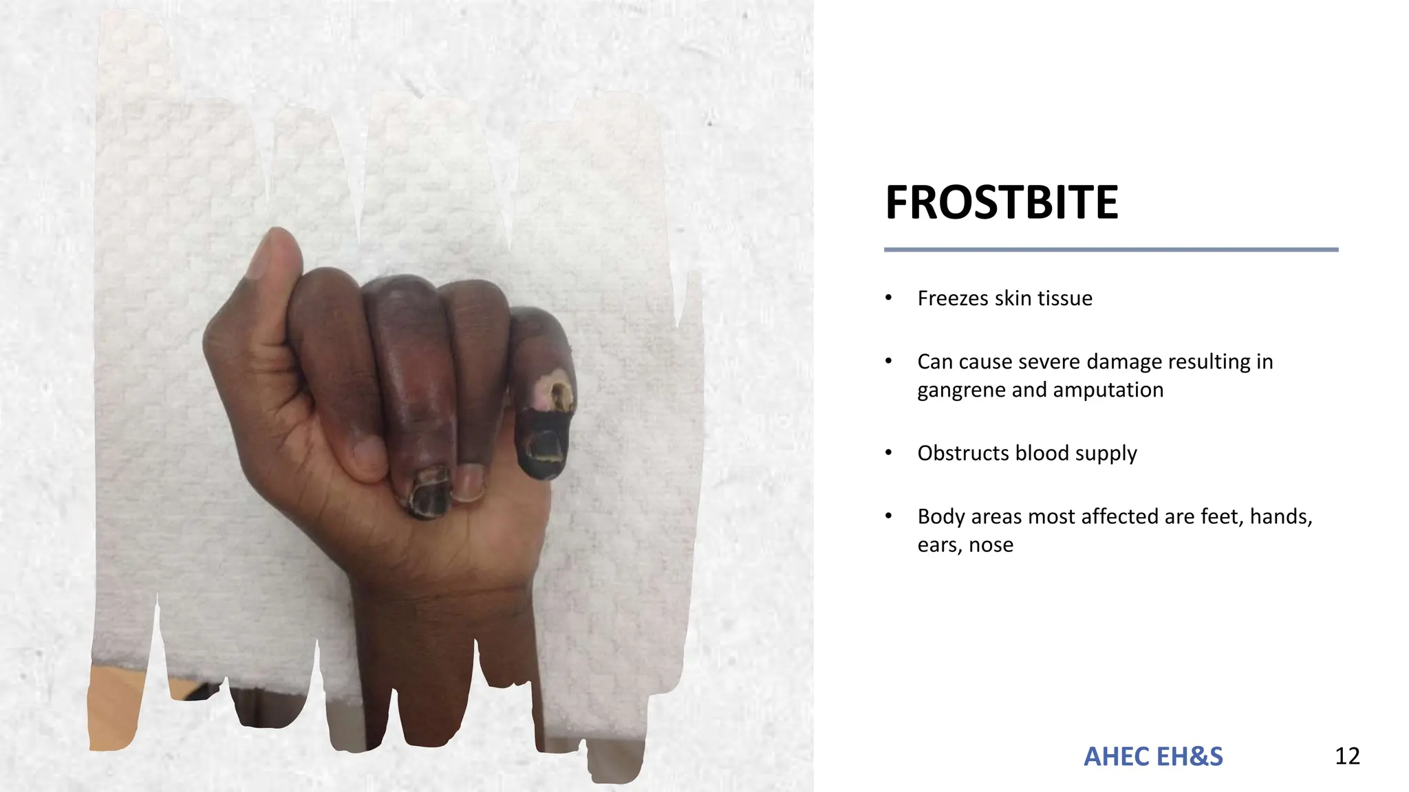 Winter Safety | PPTX