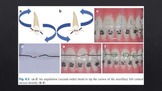 Wire bending in orthodontics (dr nayaungbds phd) | PPTX