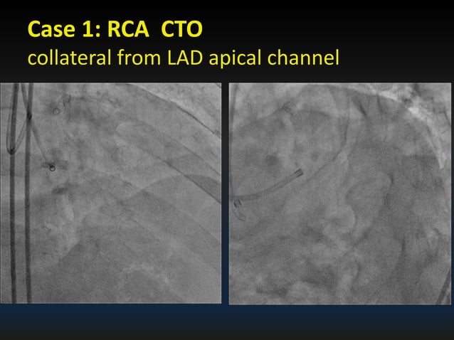 CTO fundamental: Understanding of Wire Structure | PPTX | Sports ...