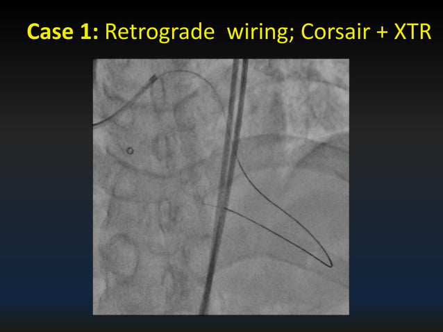 CTO fundamental: Understanding of Wire Structure | PPTX | Sports ...