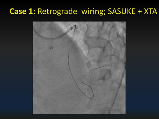 CTO fundamental: Understanding of Wire Structure | PPTX | Sports ...