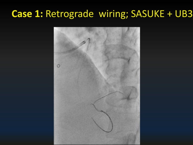 CTO fundamental: Understanding of Wire Structure | PPTX | Sports ...