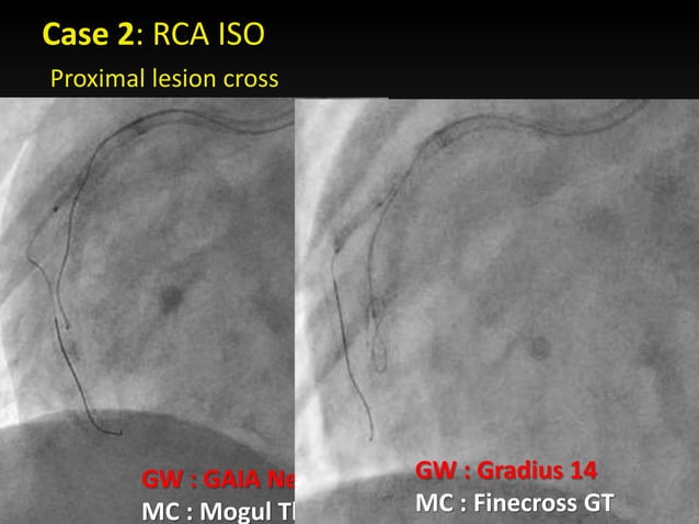 CTO fundamental: Understanding of Wire Structure | PPTX | Sports ...