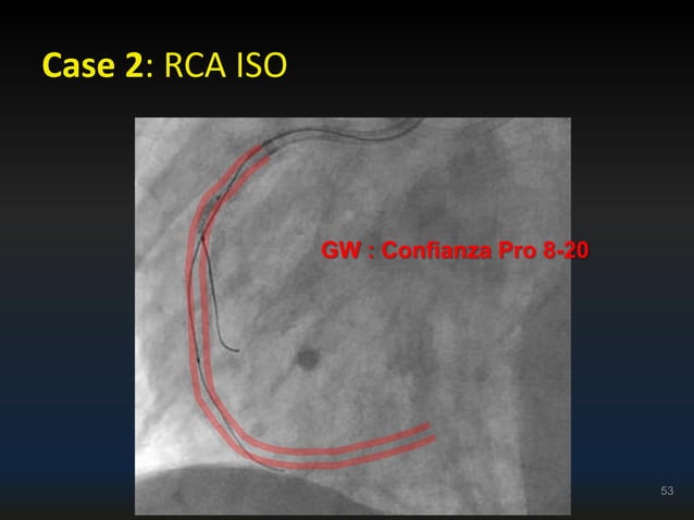 CTO fundamental: Understanding of Wire Structure | PPTX | Sports ...