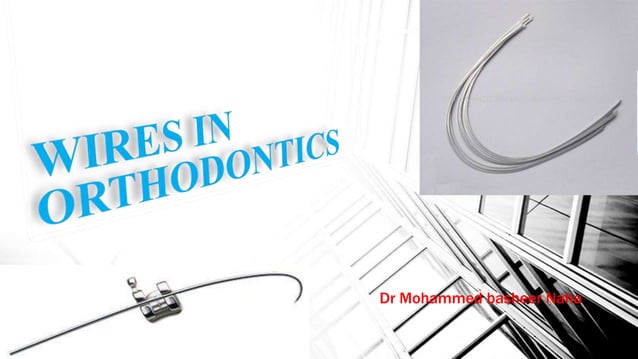 Wires in orthodontics | PPTX | Chemistry | Science