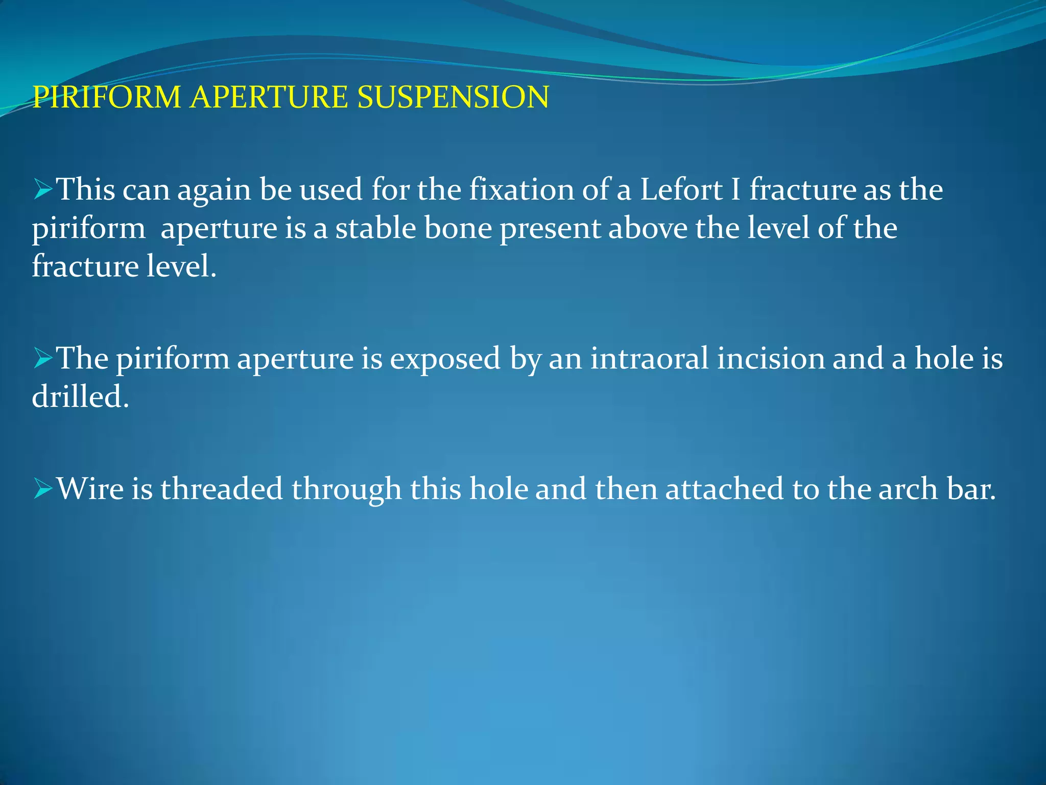 Wiring techniques in maxillofacial surgery | PPTX
