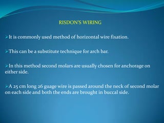 Wiring techniques in maxillofacial surgery | PPTX