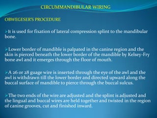Wiring techniques in maxillofacial surgery | PPTX