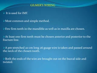 Wiring techniques in maxillofacial surgery | PPTX