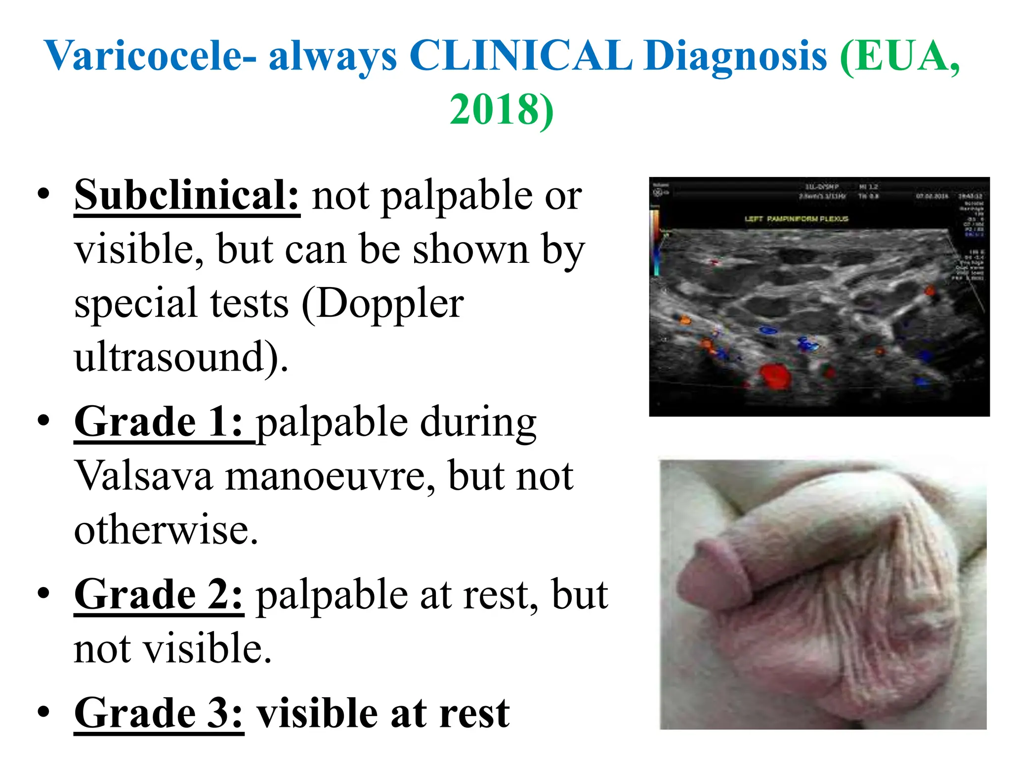 Approach to abnormal semen analysis- way forward | PPTX