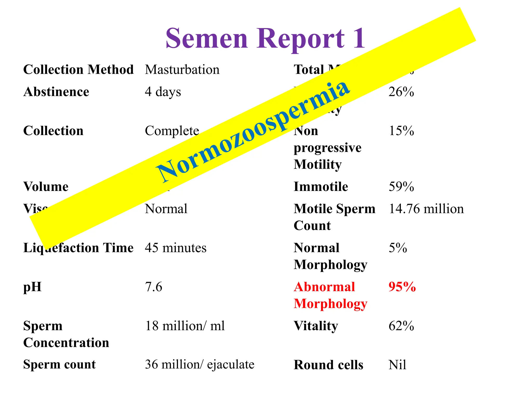 Approach to abnormal semen analysis- way forward | PPTX