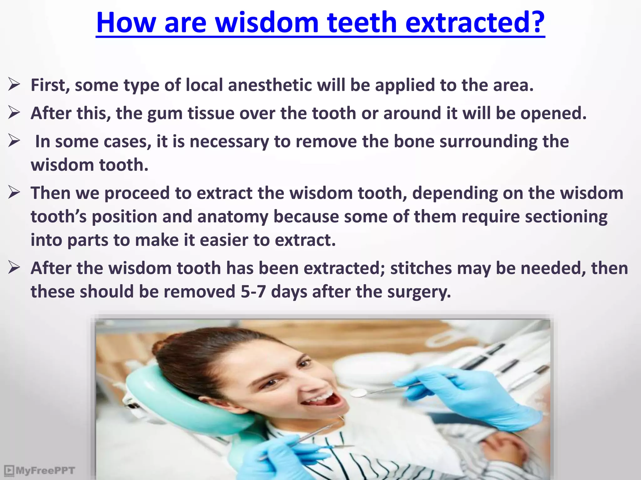 Wisdom teeth | PDF