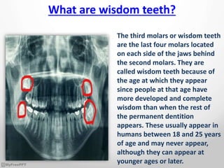 Wisdom teeth | PDF