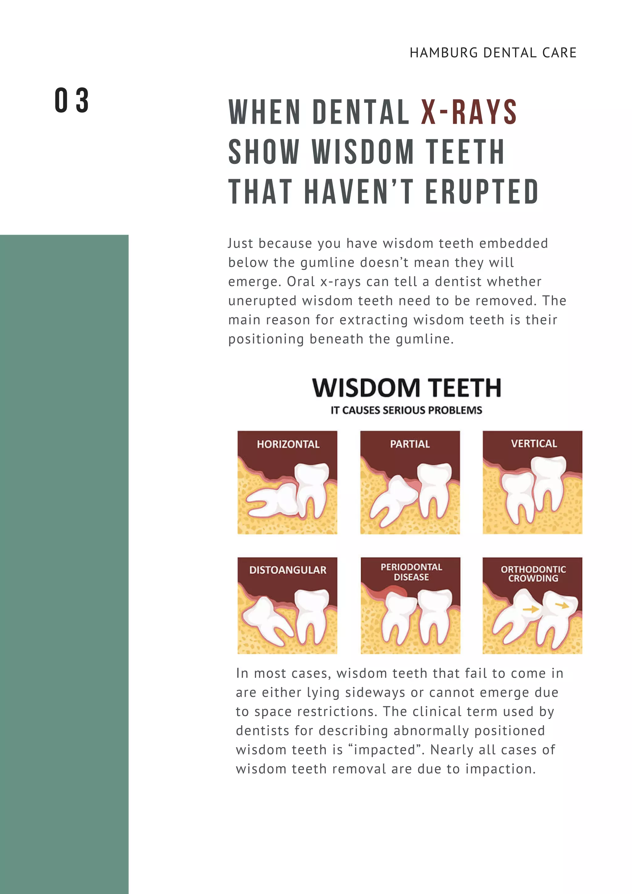 Wisdom teeth why we have them and when to remove them | PDF