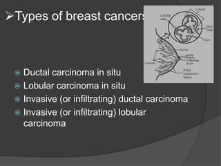AN OVERVIEW OF MEDICAL IMAGING TECHNIQUES USED IN BREAST CANCER | PPTX