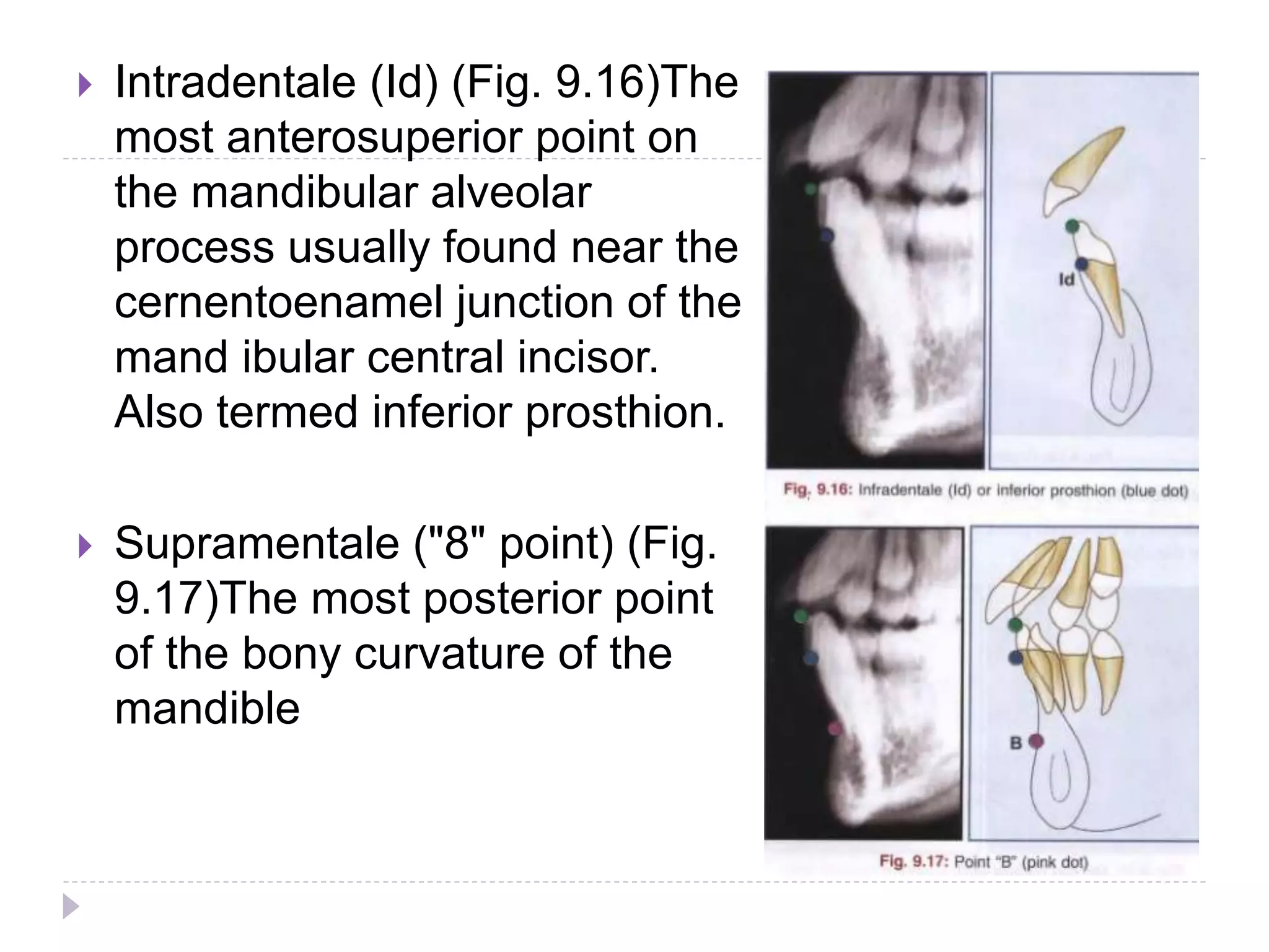 cephalometric in orthodontics and Wits appraisal | PPTX
