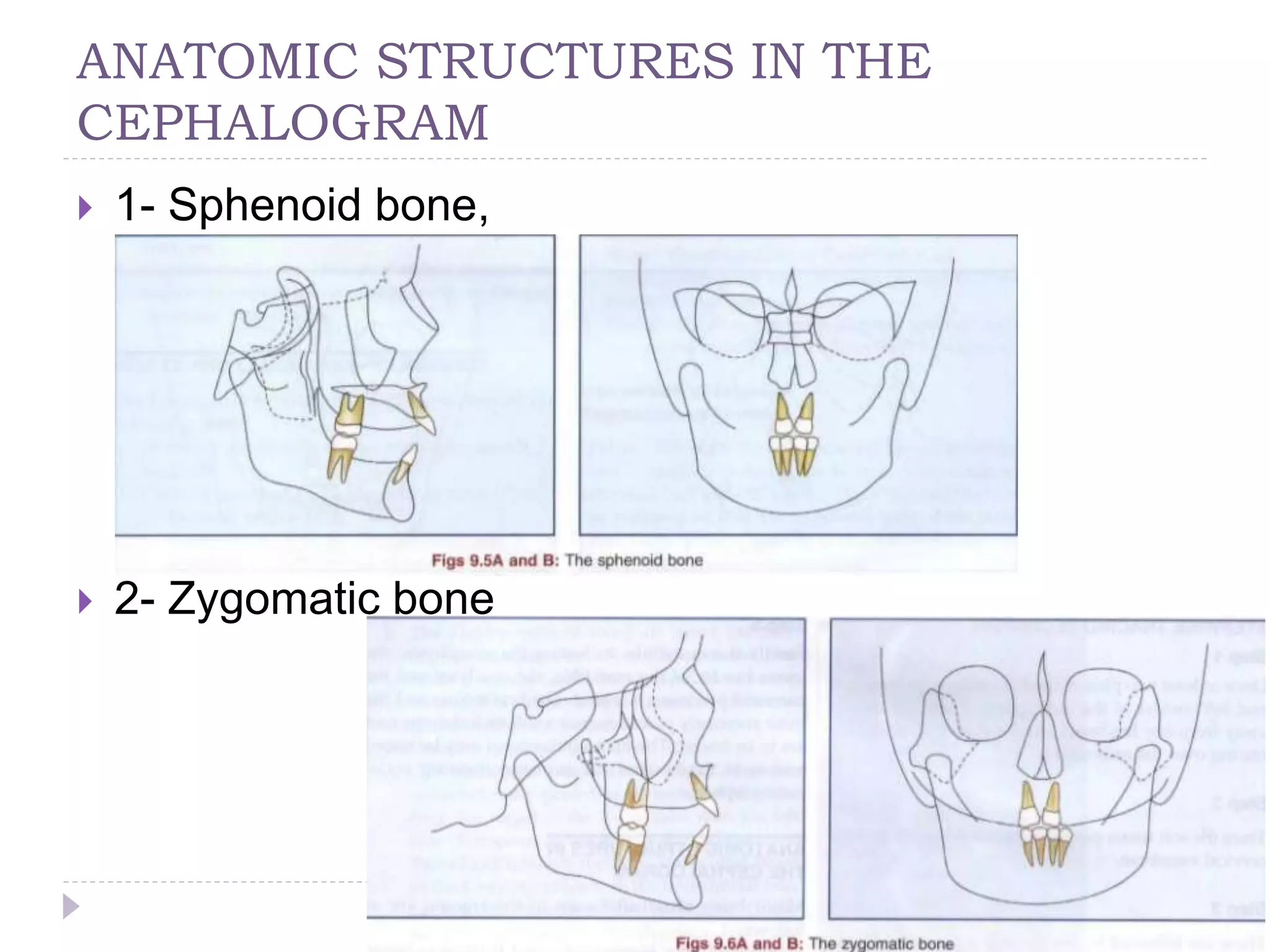 cephalometric in orthodontics and Wits appraisal | PPTX