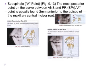 cephalometric in orthodontics and Wits appraisal | PPTX