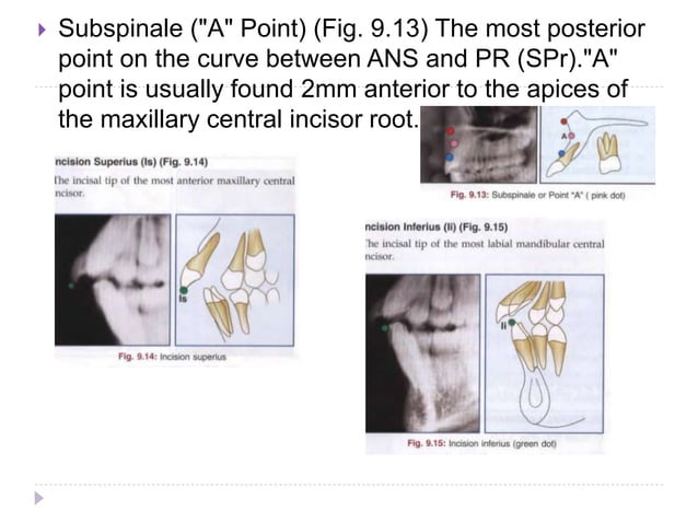 cephalometric in orthodontics and Wits appraisal | PPTX | Dental Health ...