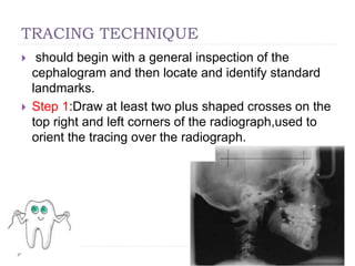 cephalometric in orthodontics and Wits appraisal | PPTX