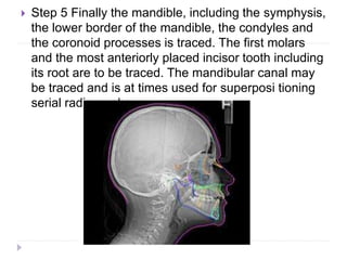 cephalometric in orthodontics and Wits appraisal | PPTX