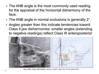 cephalometric in orthodontics and Wits appraisal | PPTX