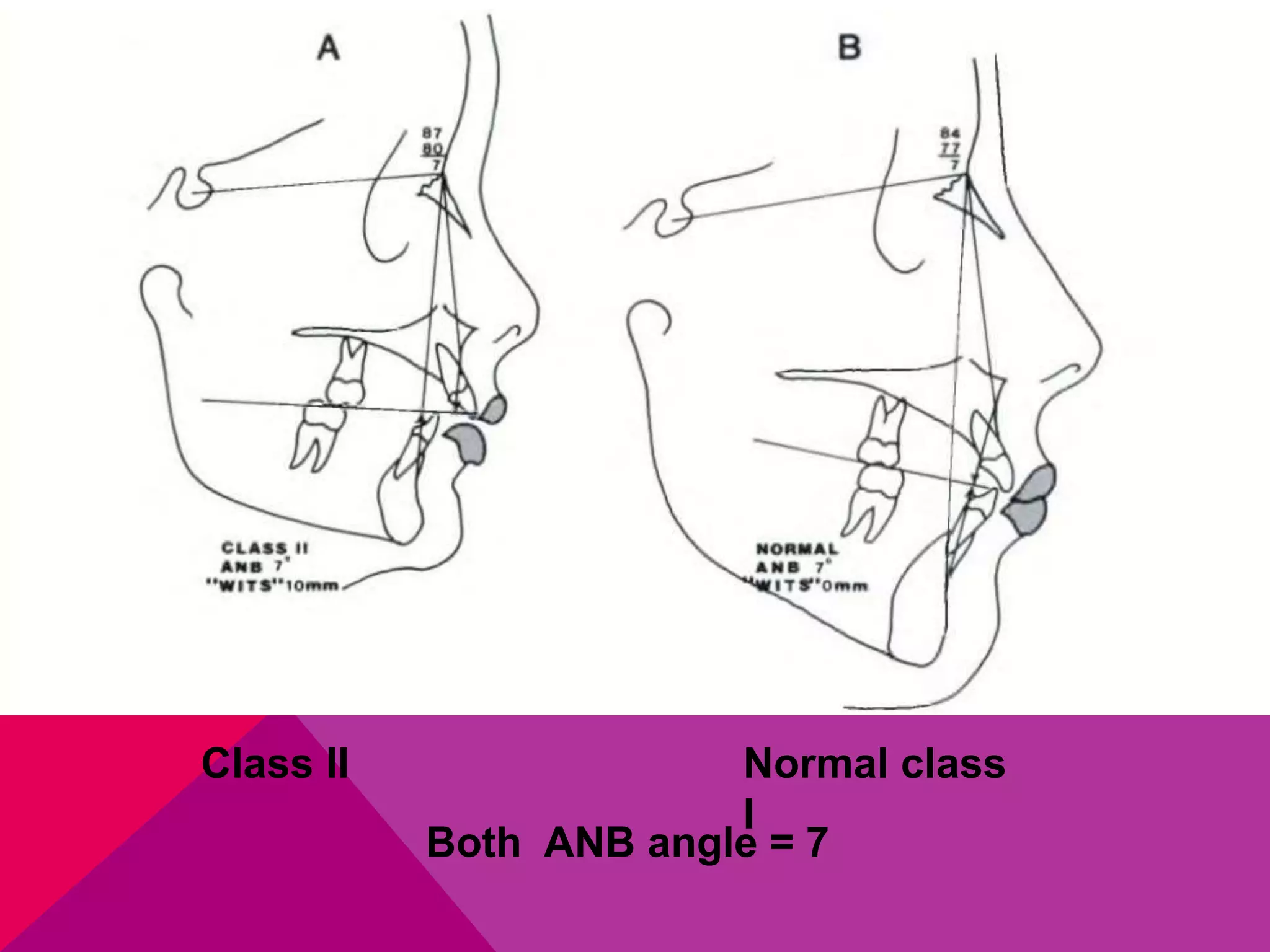 Wits appraisal | PPTX