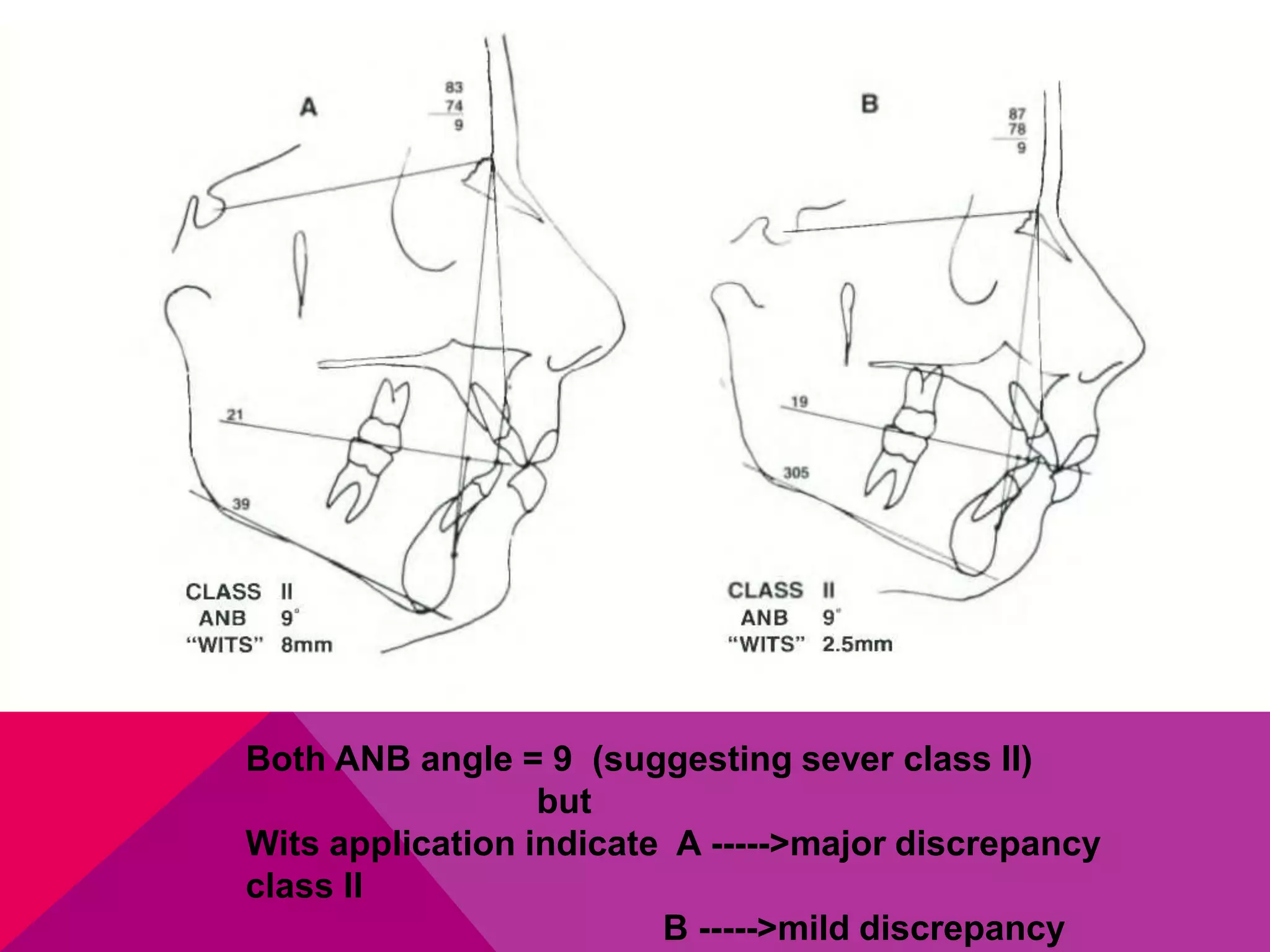 Wits appraisal | PPTX