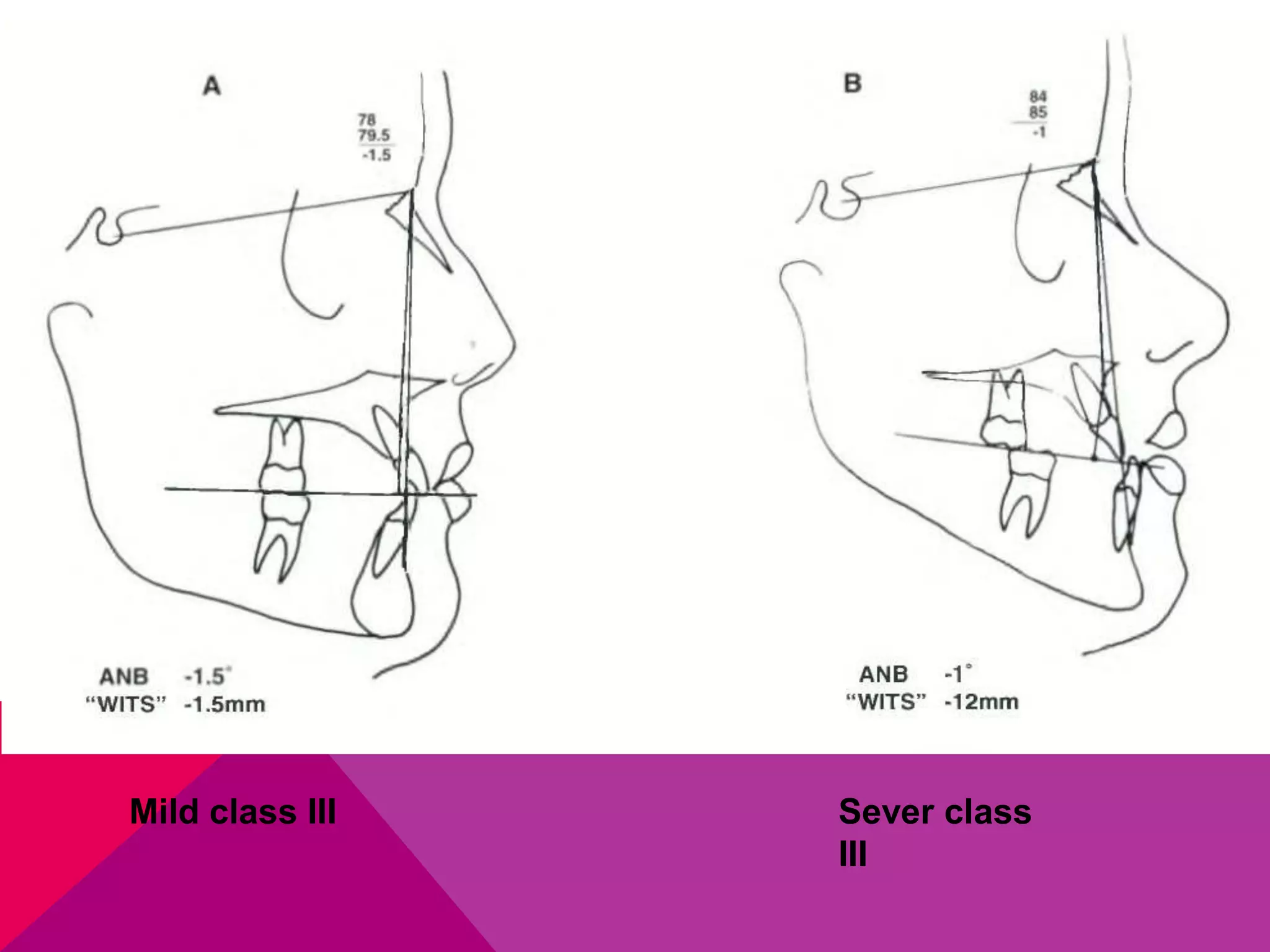 Wits appraisal | PPTX