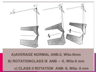 Wits appraisal | PPTX