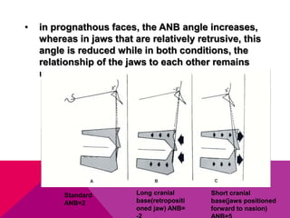 Wits appraisal | PPTX