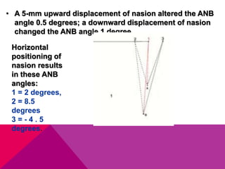 Wits appraisal | PPTX