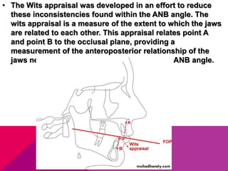 Wits appraisal | PPT