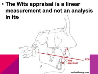 Wits appraisal | PPT