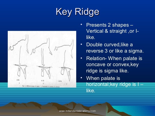 Wits, sassouni, jarabak /certified fixed orthodontic courses by India…