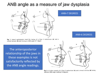 WITTS APPRAISAL fgrthfdgawi ref 18 april.pptx