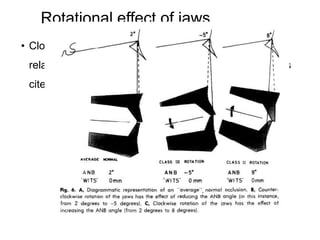 WITTS APPRAISAL fgrthfdgawi ref 18 april.pptx