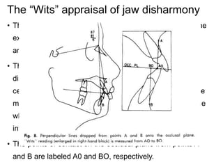 WITTS APPRAISAL fgrthfdgawi ref 18 april.pptx
