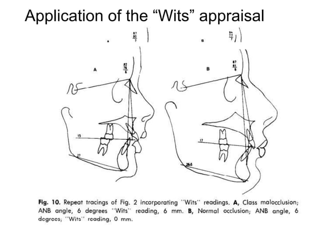 WITTS APPRAISAL fgrthfdgawi ref 18 april.pptx