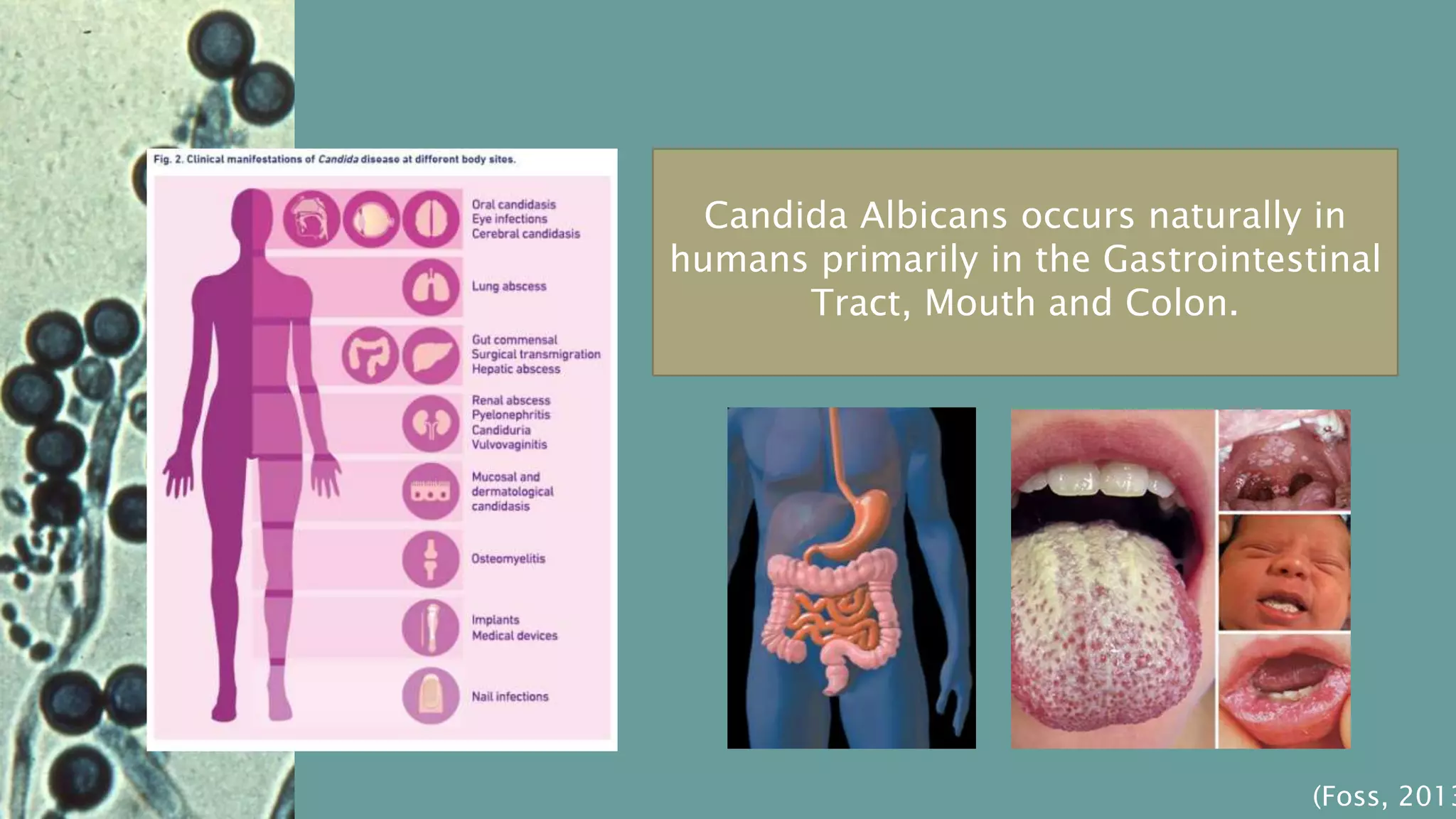 Microbial CV on Candida albicans | PPTX