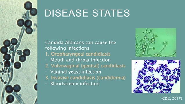 Microbial CV on Candida albicans | PPT
