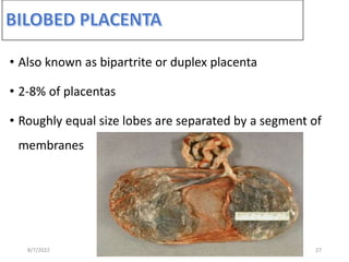 Placenta Duplex