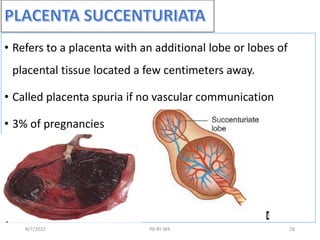 Placenta Spuria